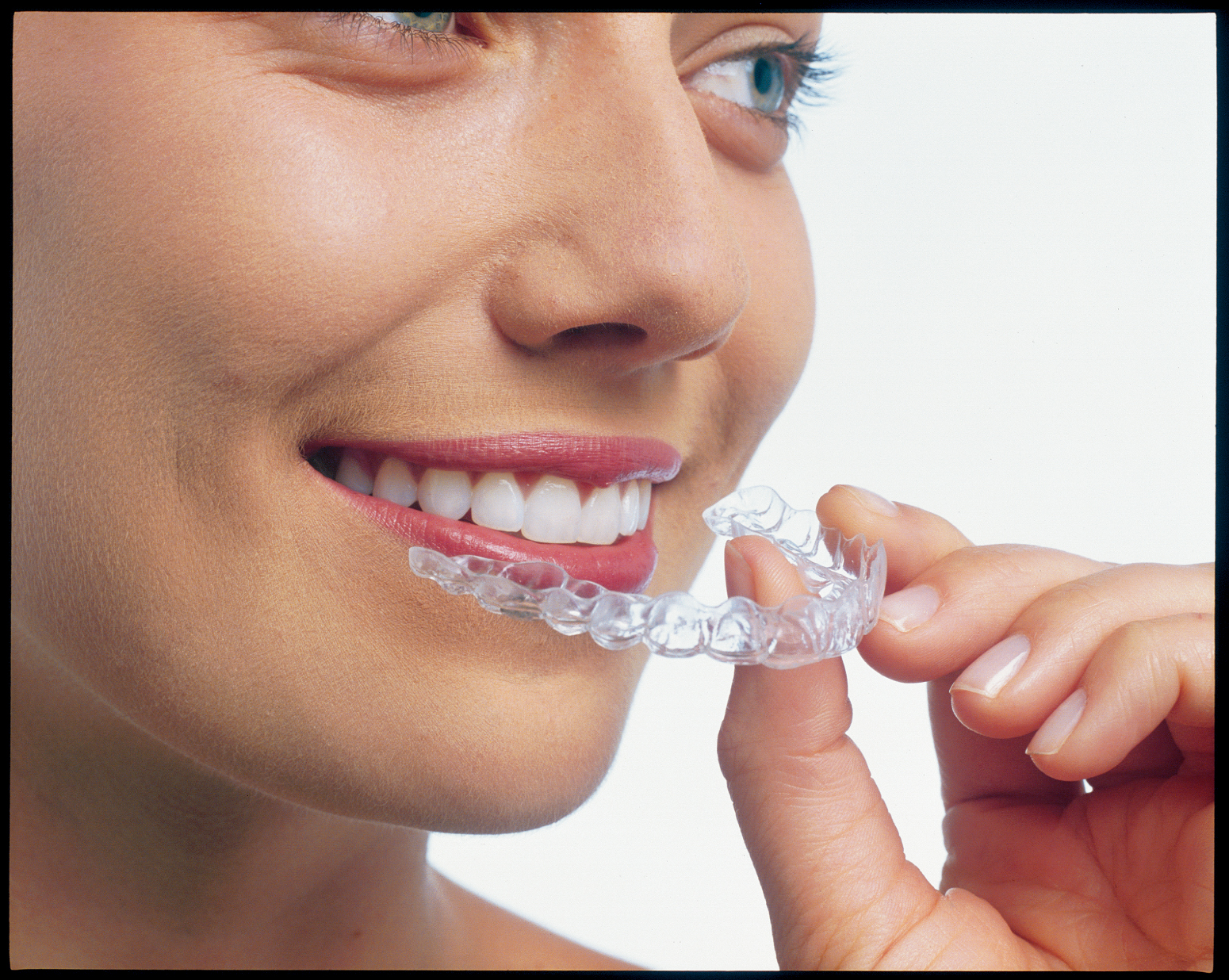Smilemakers How Does Invisalign Work